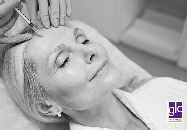 5 Signs It’s Time To Consider Botox | Glo Skin & Medspa